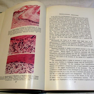 1962 Atlas of Histopathology of the Skin, Vintage Dermatology, Skin ...