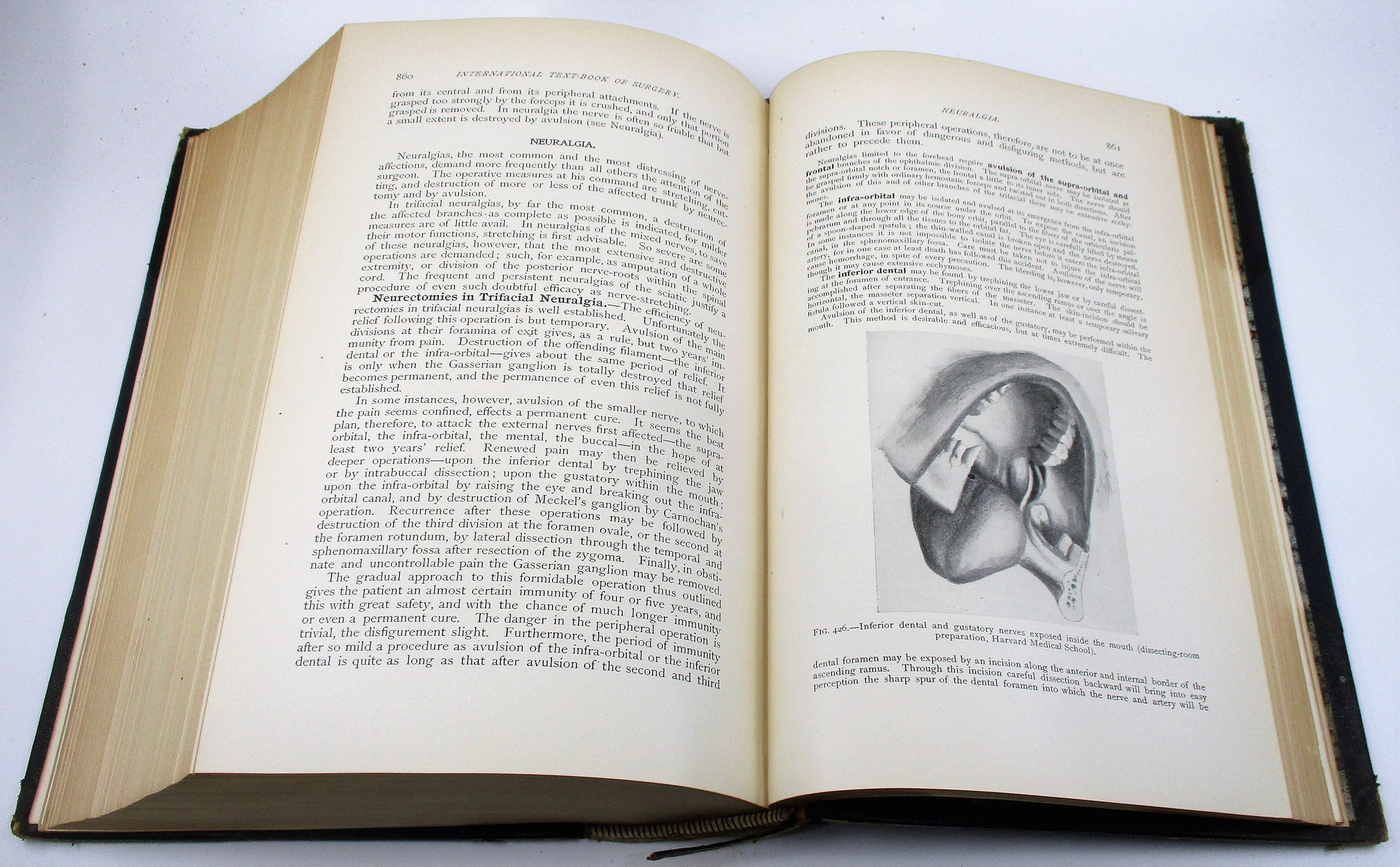 1900 Surgery International Textbook of Surgery Old Anatomy - Etsy