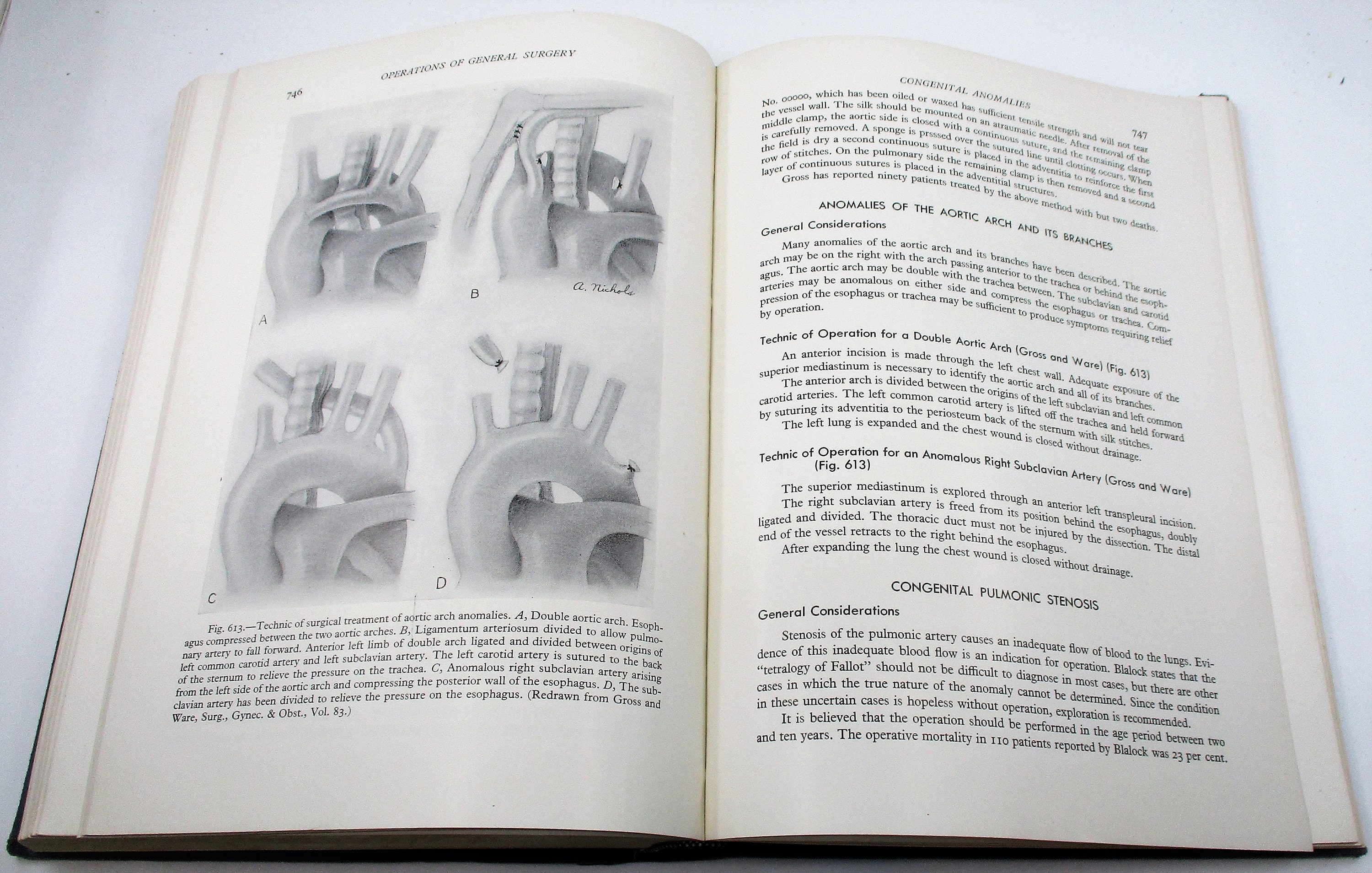 1951 Operations of General Surgery, Vintage Medical School Textbook ...