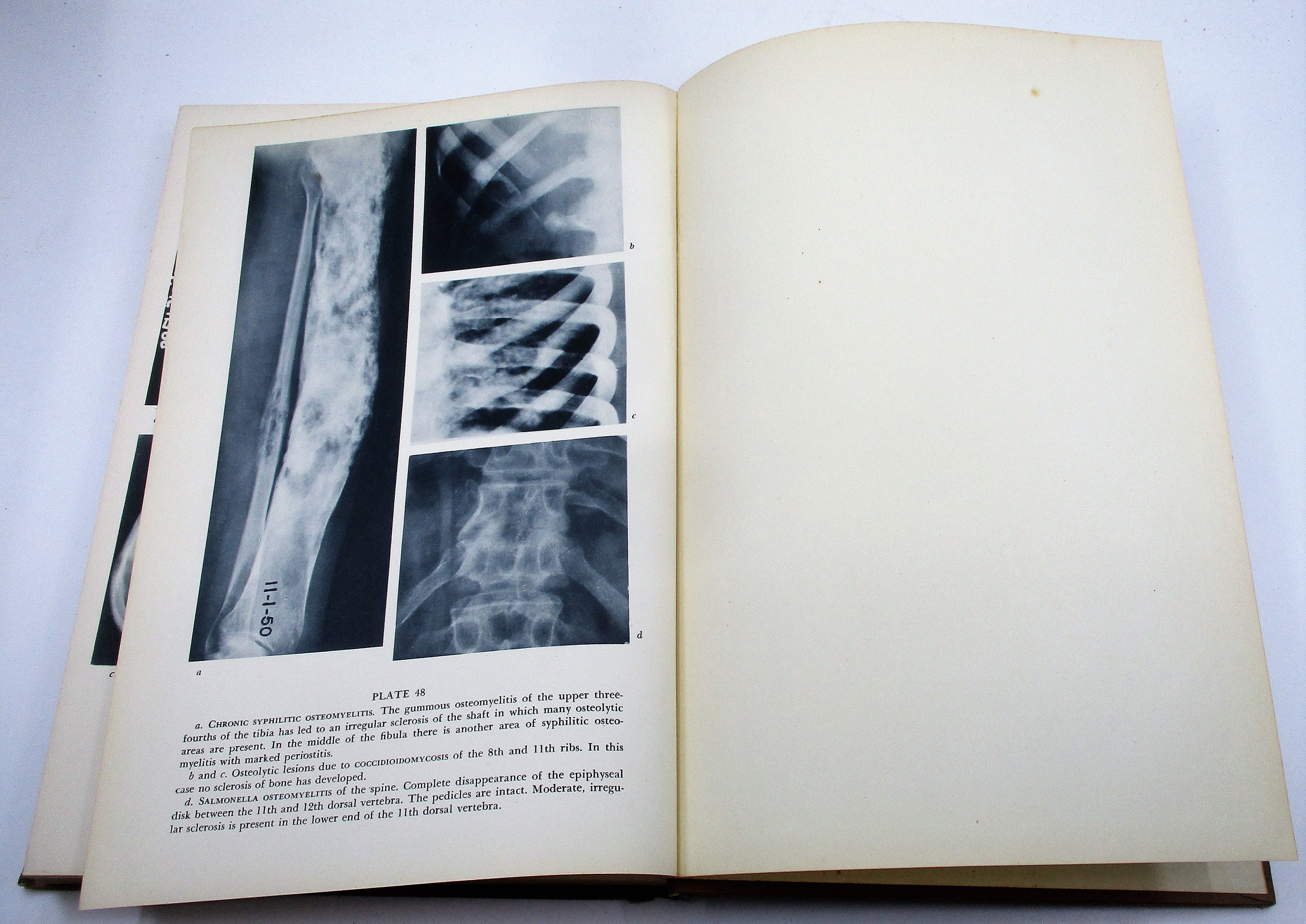1957 Bone Diseases, Vintage Anatomy, Internal Medicine, Physiology ...