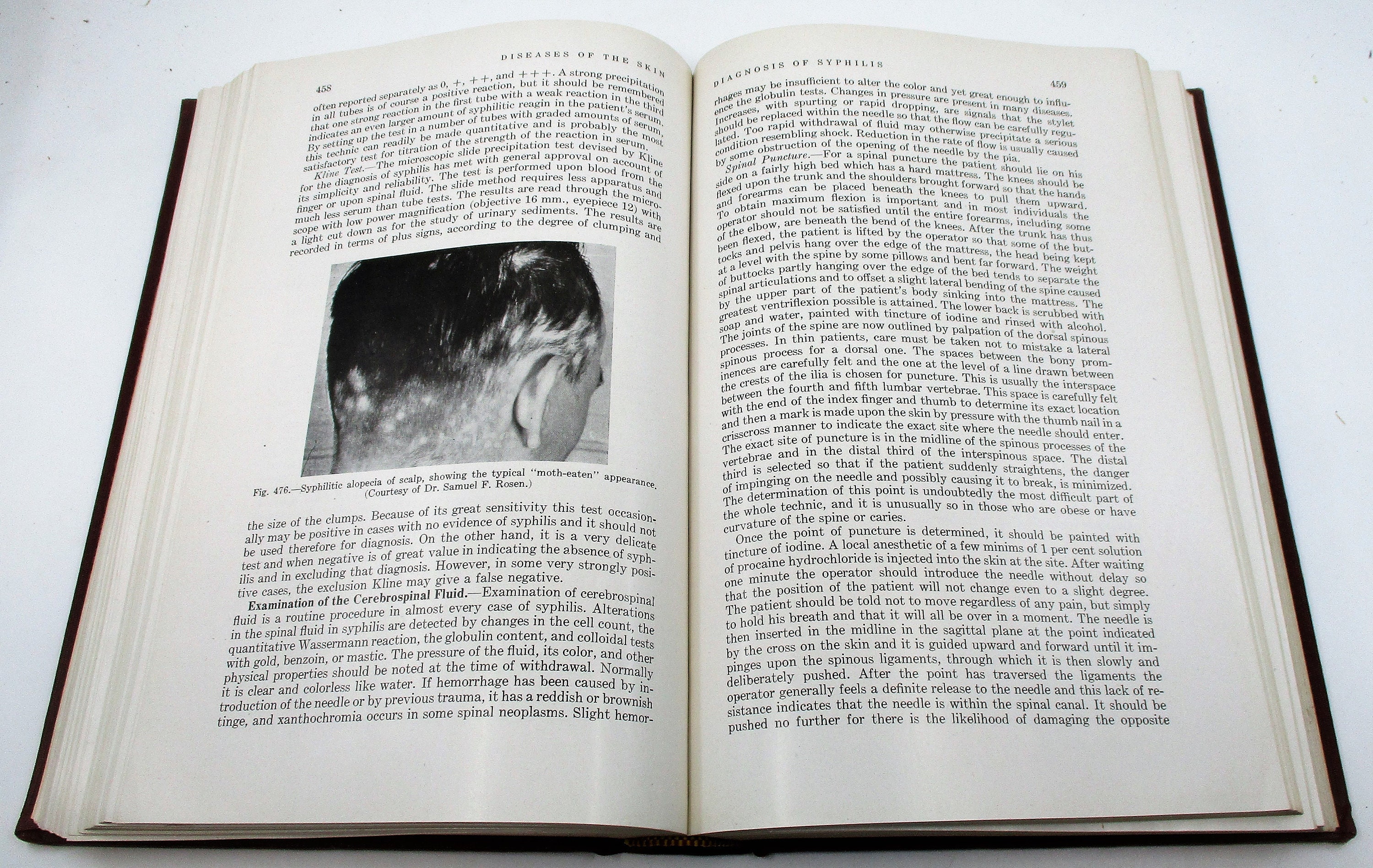 1946 Diseases of the Skin, Vintage Dermatology Medicine Book, Skin ...