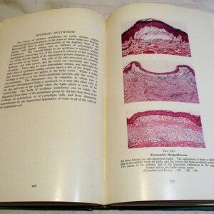 1962 Atlas of Histopathology of the Skin, Vintage Dermatology, Skin ...