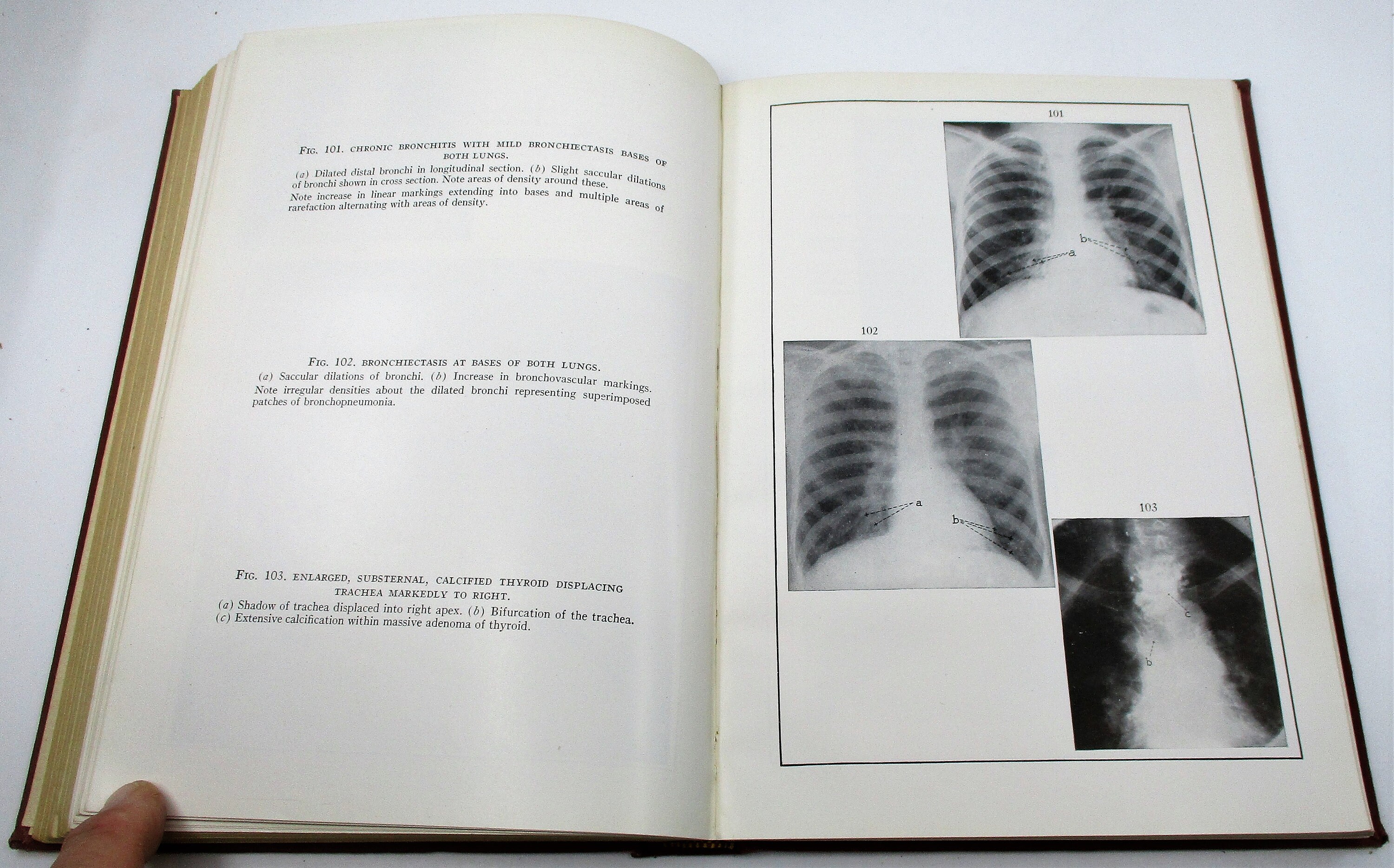 1946 Roentgen Diagnosis, X-rays, Anatomy, Internal Medicine, Physiology ...