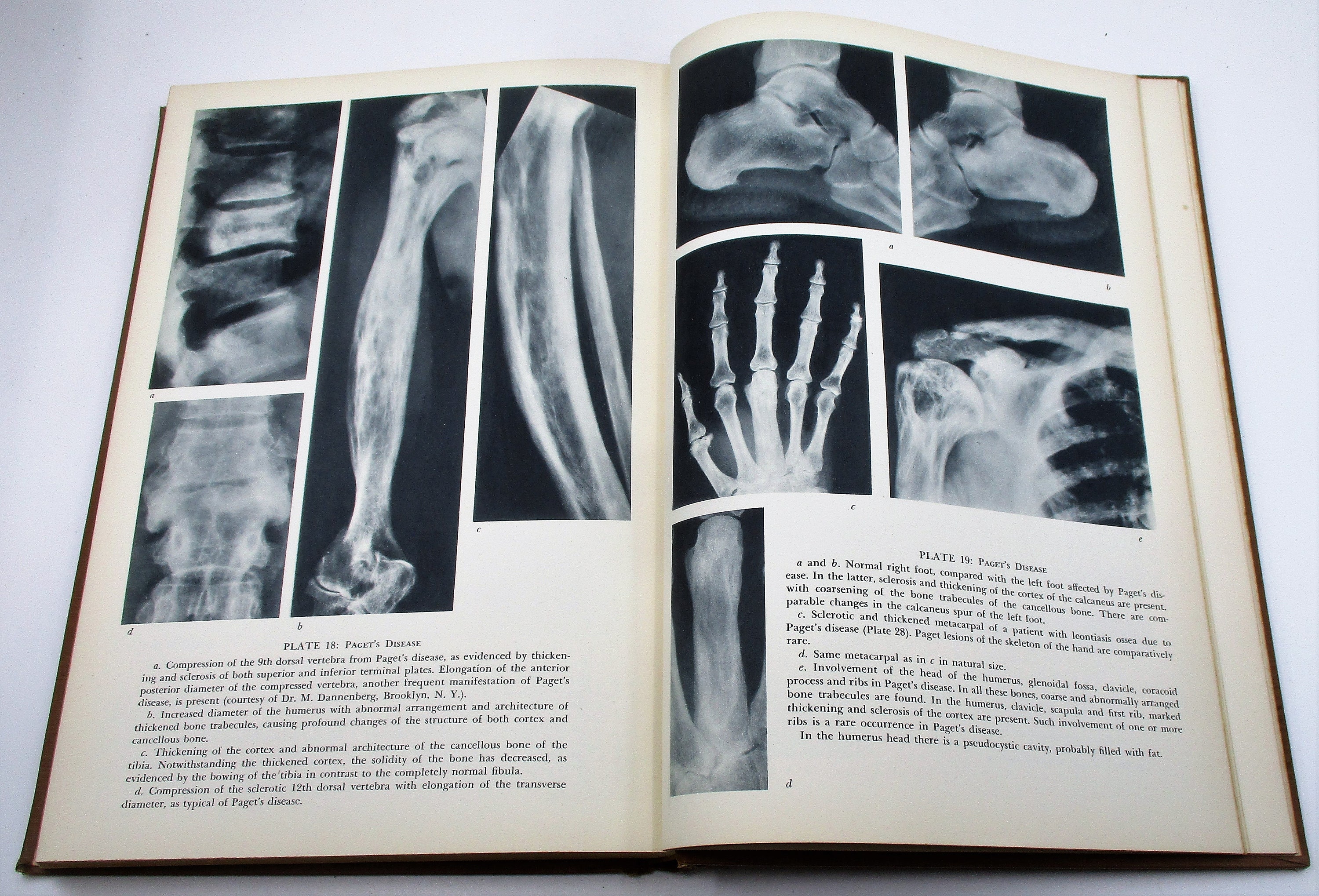1957 Bone Diseases, Vintage Anatomy, Internal Medicine, Physiology ...