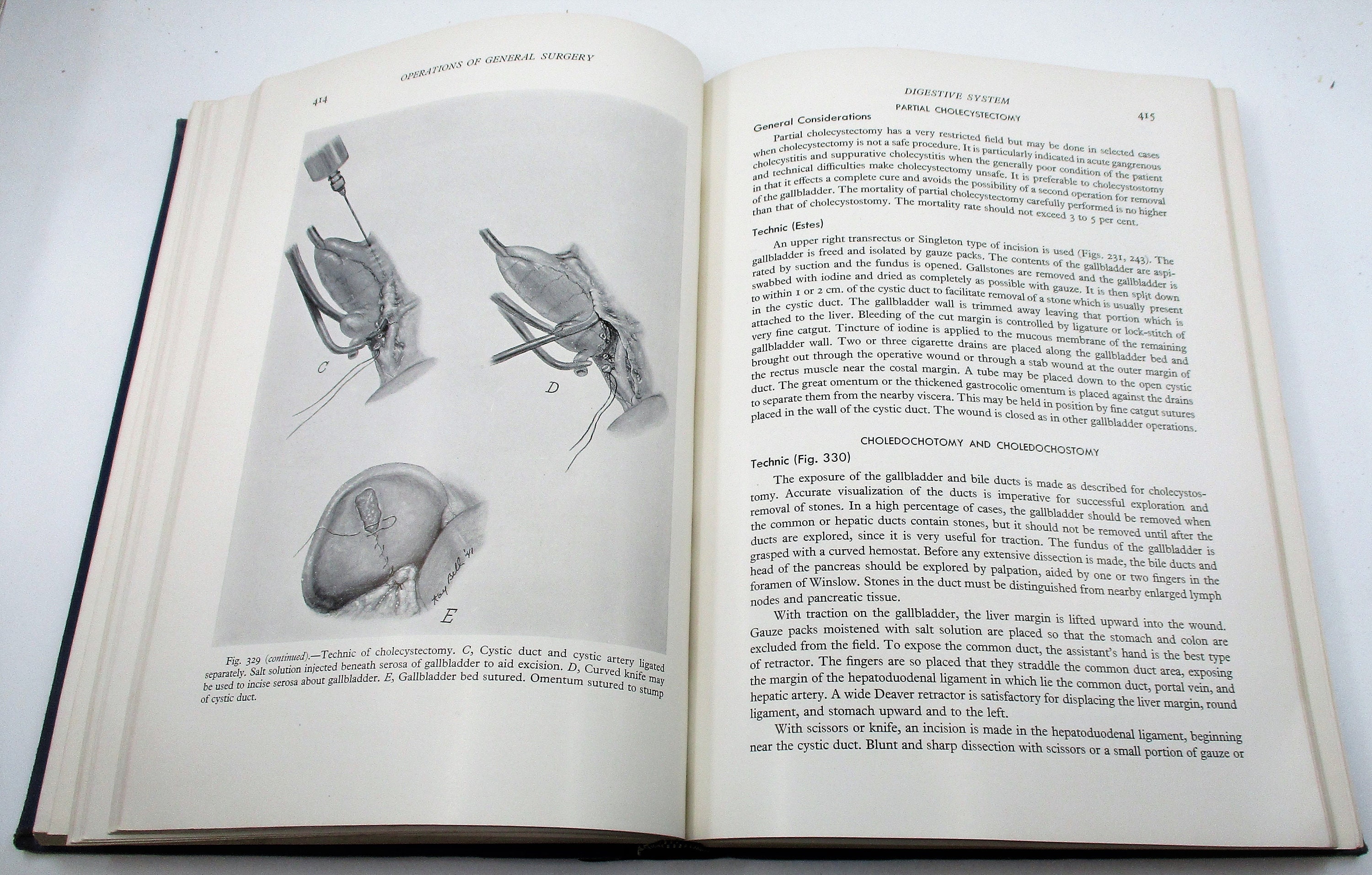 1951 Operations of General Surgery, Vintage Medical School Textbook ...