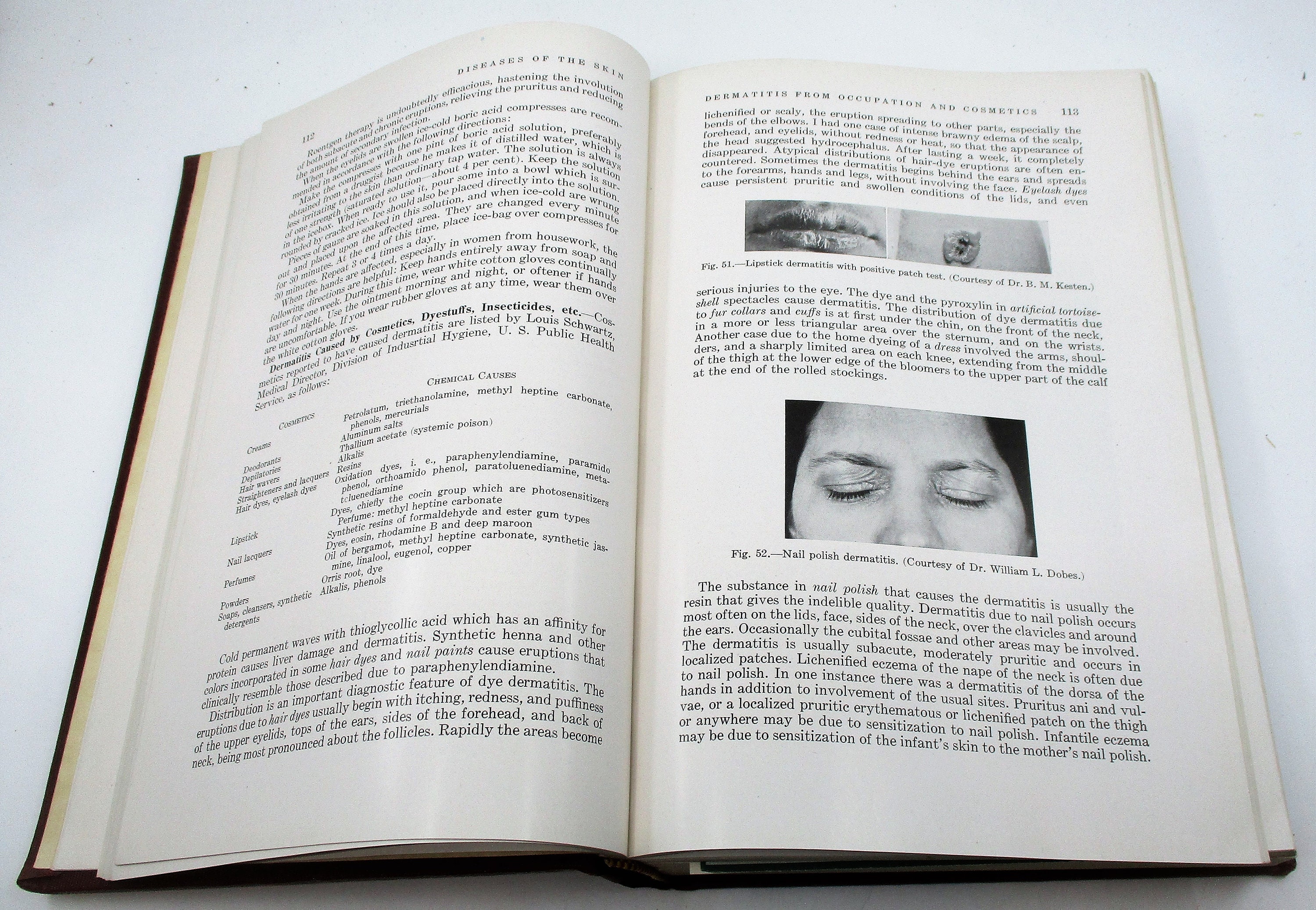 1946 Diseases of the Skin, Vintage Dermatology Medicine Book, Skin ...