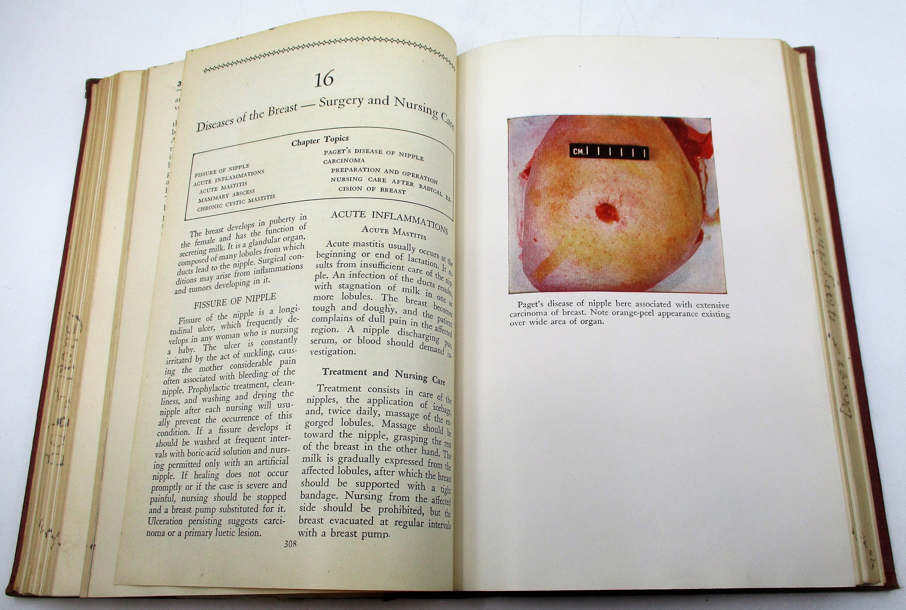 1947 Surgical Nursing, Nursing School Textbook, Vintage Anatomy ...