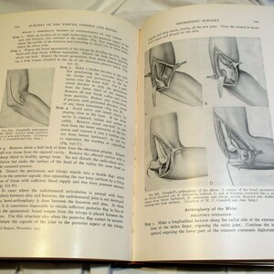 1938 Modern Surgery Technic, All 3 Volumes, Anatomy and Operative ...