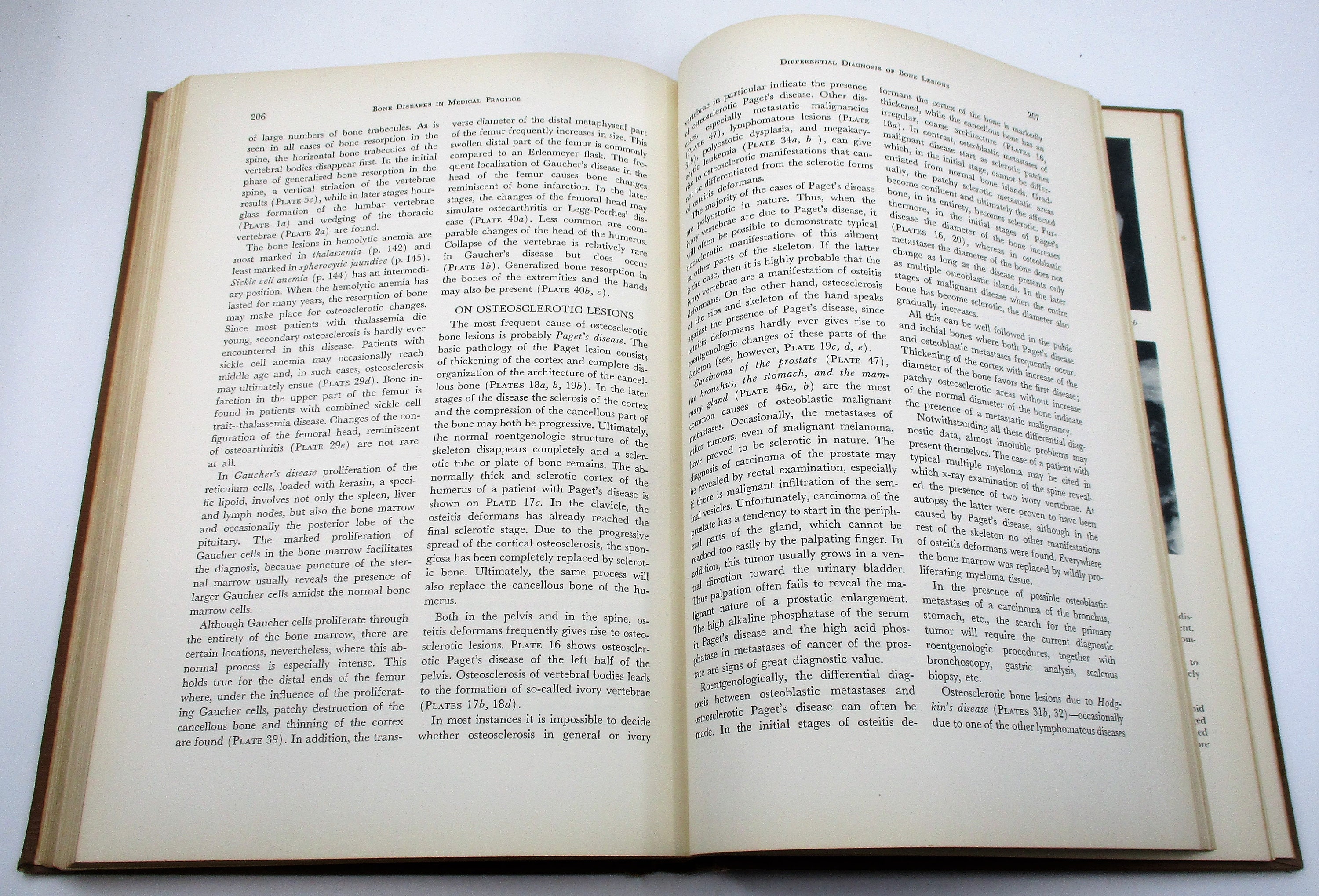 1957 Bone Diseases, Vintage Anatomy, Internal Medicine, Physiology ...