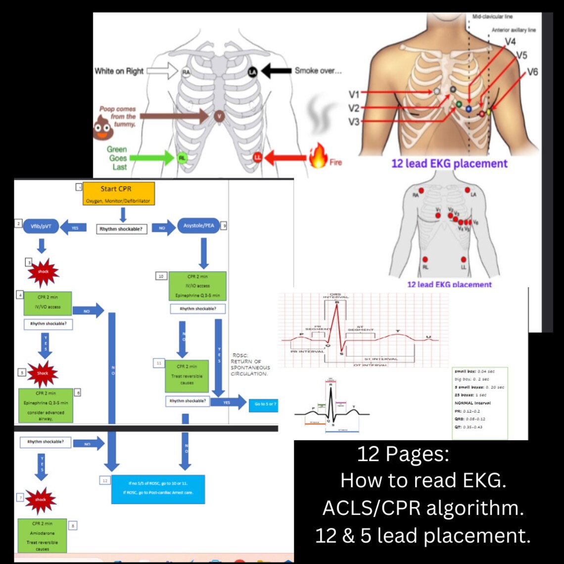 Nurse Student/nursing School/nclex Study Guide EKG Interpretation/ Acls ...