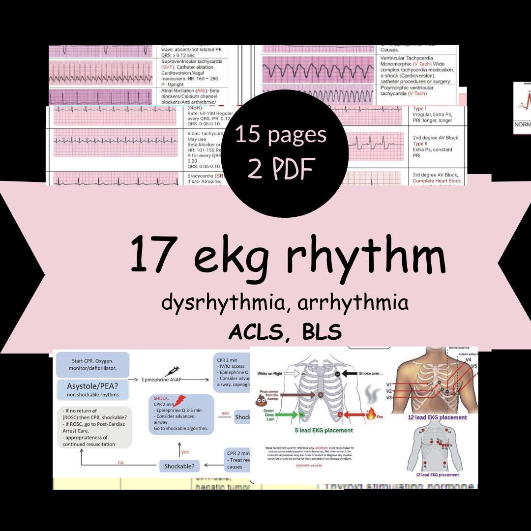 Cardiac Ekg Interpretation Nursing School Student RN Ecg & Dysrhythmias ...