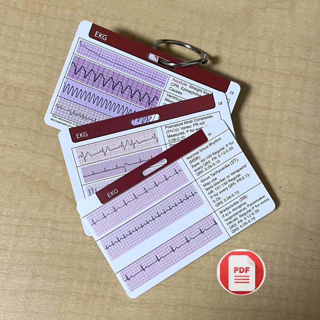 EKG Badge 3 Card Set + (free PDF), ECG Rhythms Cheat Sheet, Ekg ...