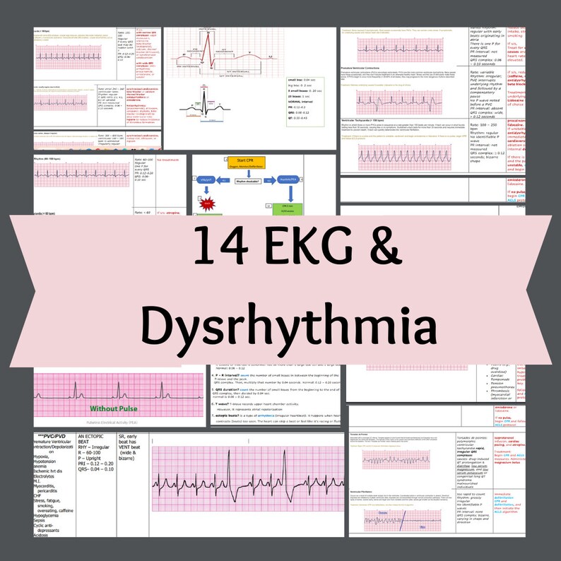 Cardiac Ekg Interpretation Nursing School Student RN Ecg & Dysrhythmias ... Cardiac Ekg Interpretation Nursing School Student RN Ecg & Dysrhythmias ...