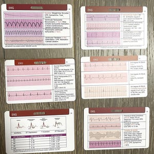 6 Set EKG Cardiac Rhythms, Nurse Badge Reference 6 Cards Acls, Cpr, Code Blue paramedics, Emt ...