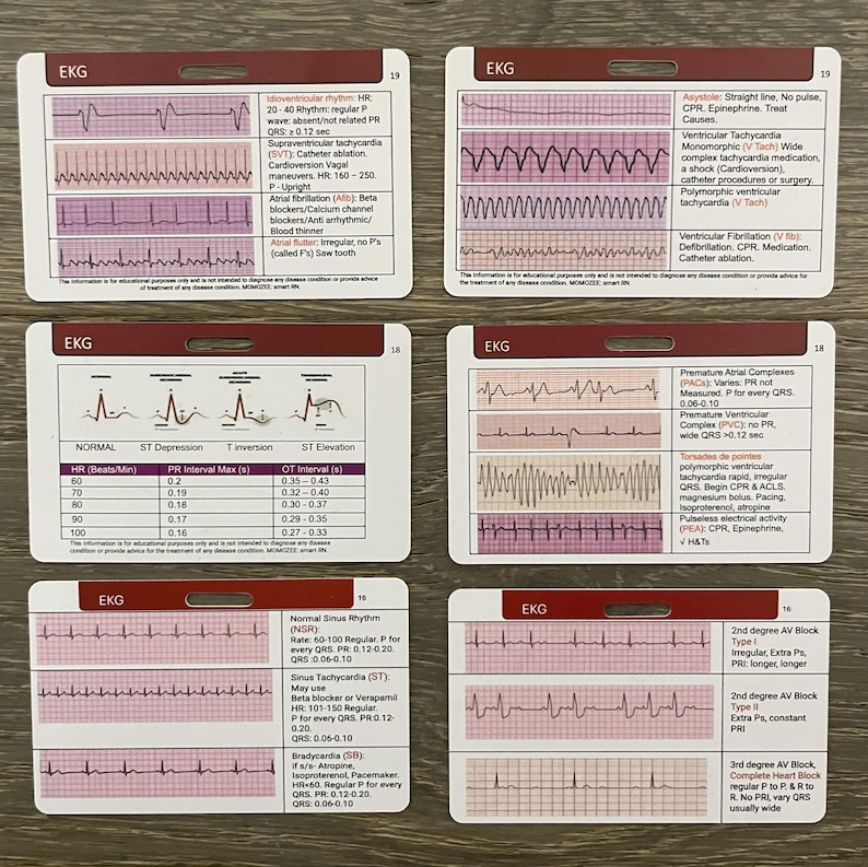 EKG Interpretation Badge 4 Cards + EKG ( Study Guide PDF ): 12 + 5 Lead ...
