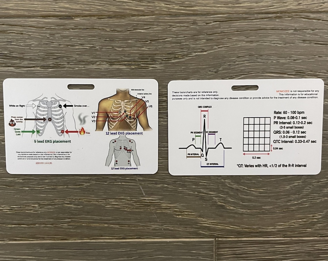 EKG Interpretation Badge 4 Cards + EKG ( Study Guide PDF ): 12 + 5 Lead ...