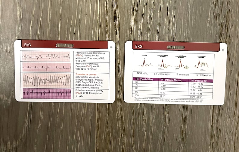 EKG Badge 3 Card Set + (free PDF), ECG Rhythms Cheat Sheet, Ekg ...