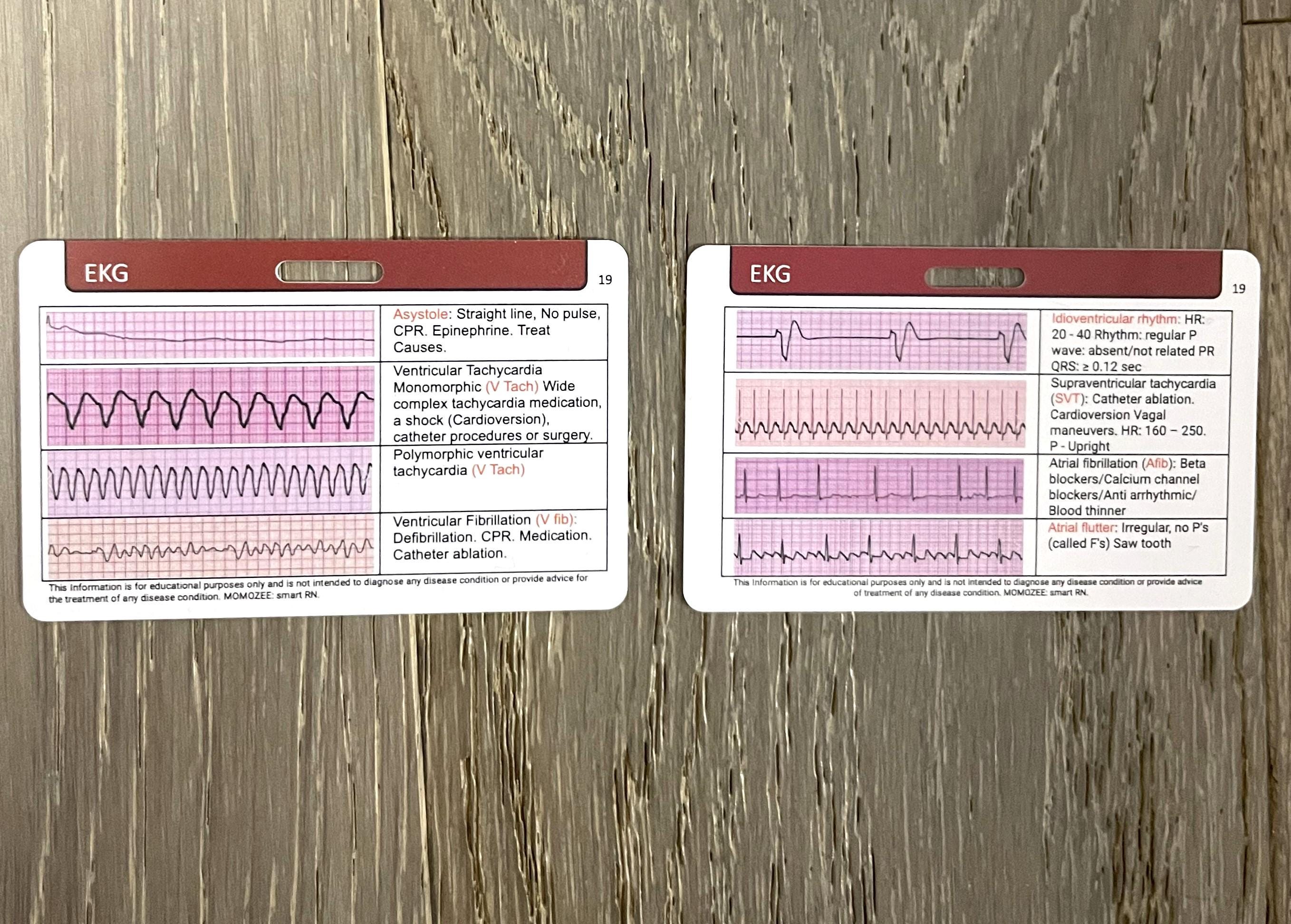 EKG Badge 3 Card Set + (free PDF), ECG Rhythms Cheat Sheet, Ekg ...