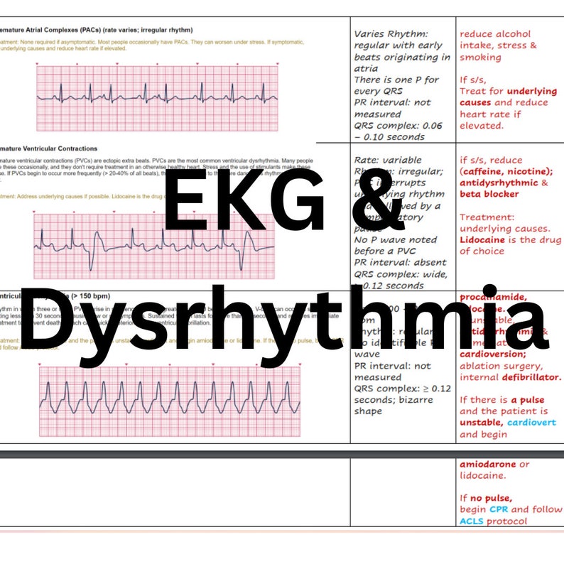 Cardiac Ekg Interpretation Nursing School Student RN Ecg & Dysrhythmias ...