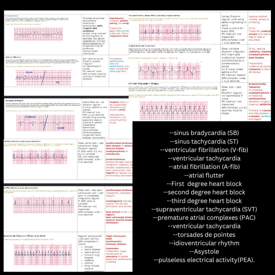 Cardiac Ekg Interpretation Nursing School Student RN Ecg & Dysrhythmias ...