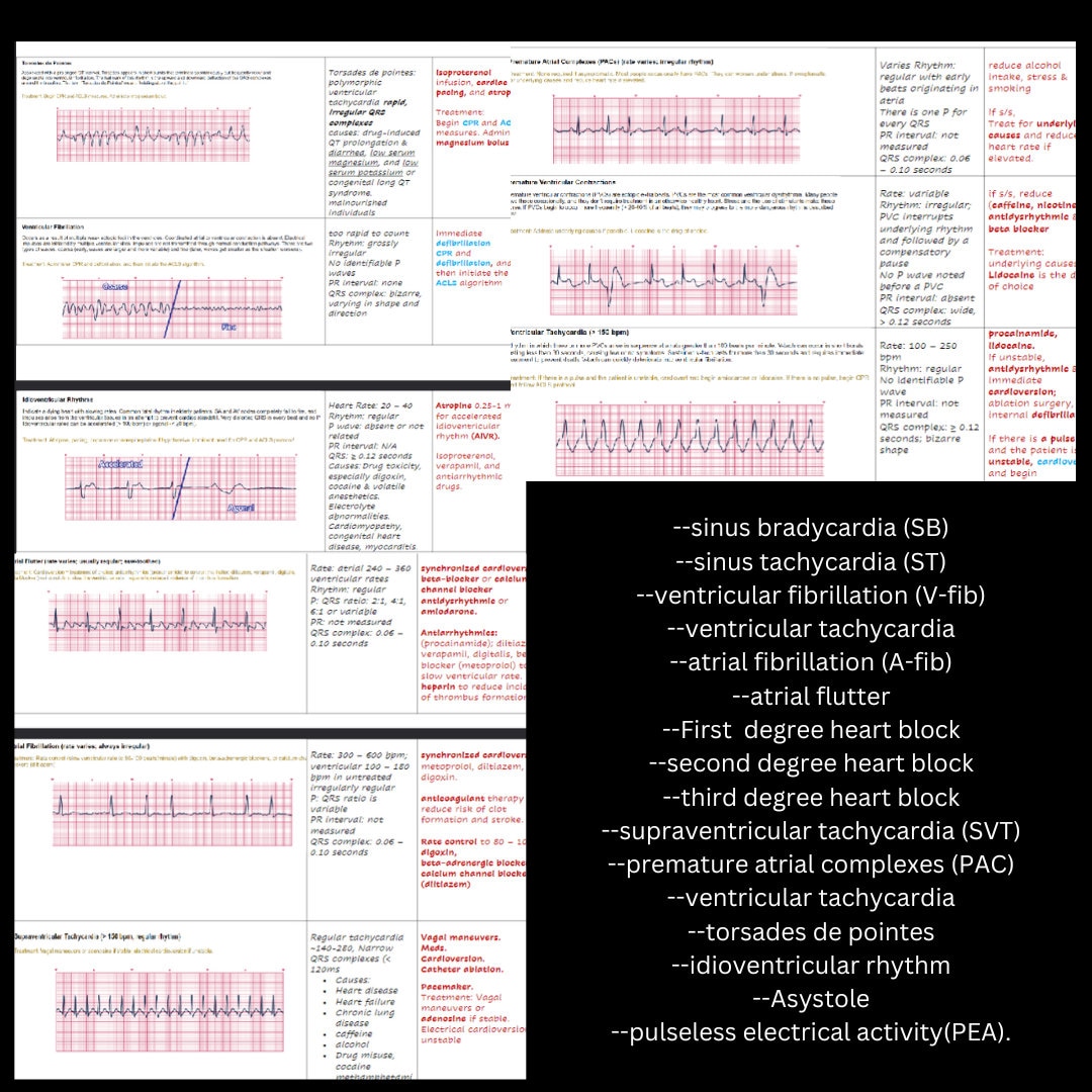 Cardiac Ekg Interpretation Nursing School Student RN Ecg & Dysrhythmias ...