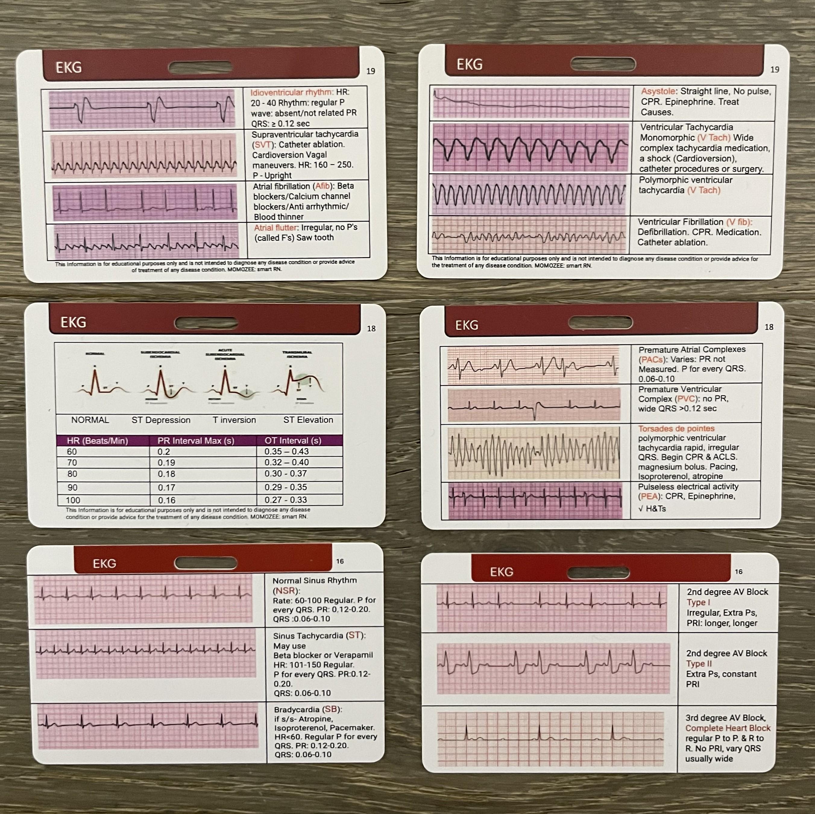 EKG Badge 3 Card Set + (free PDF), ECG Rhythms Cheat Sheet, Ekg ...