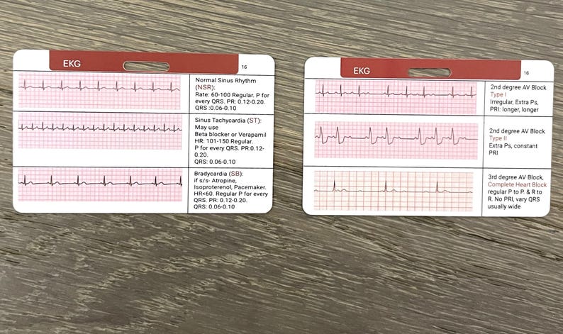 EKG Rhythm Badge Cards, ECG Interpretation Study Guide (PDF) - Etsy