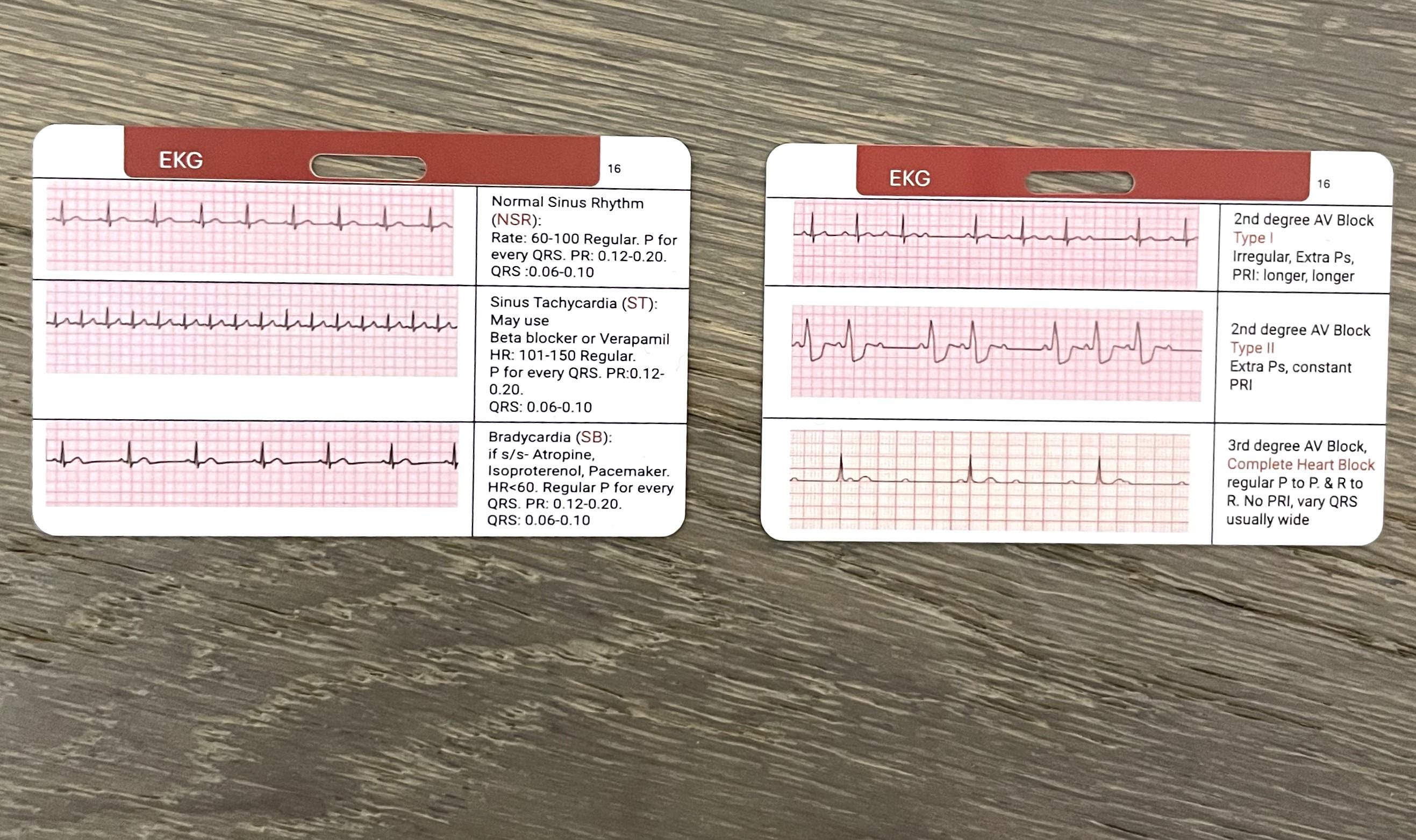 3 Set Ekg Badge Card + (PDF Ecg Rhythms Cheat Sheet), Ekg Cardiac, Tele, Nurse Pocket Card ...