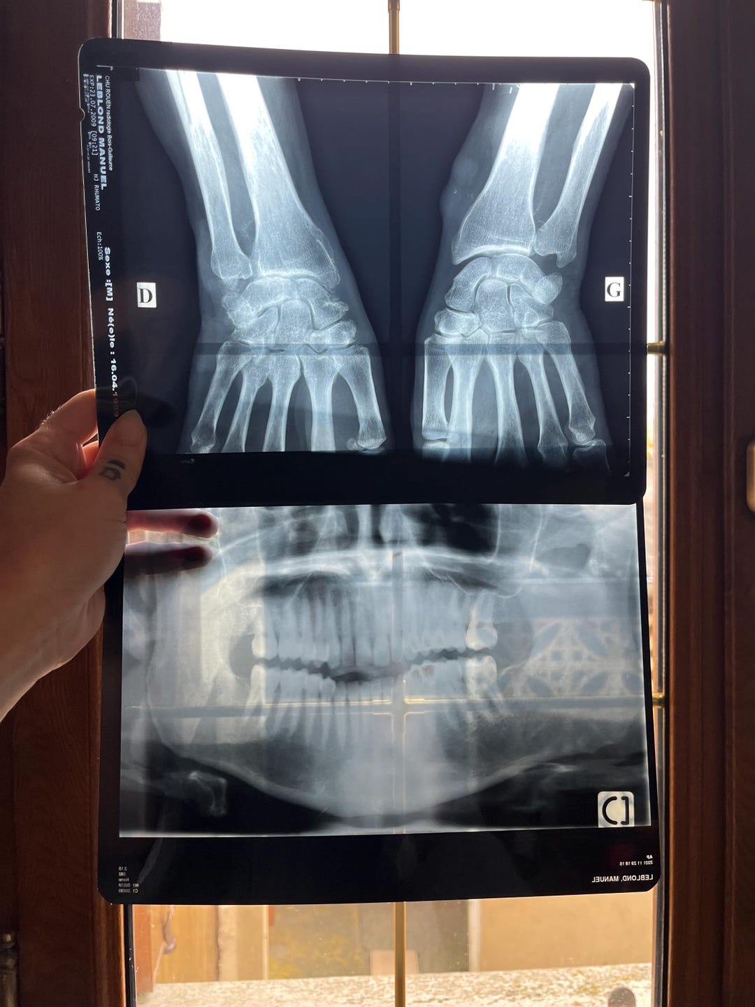 Medical X-ray - Etsy