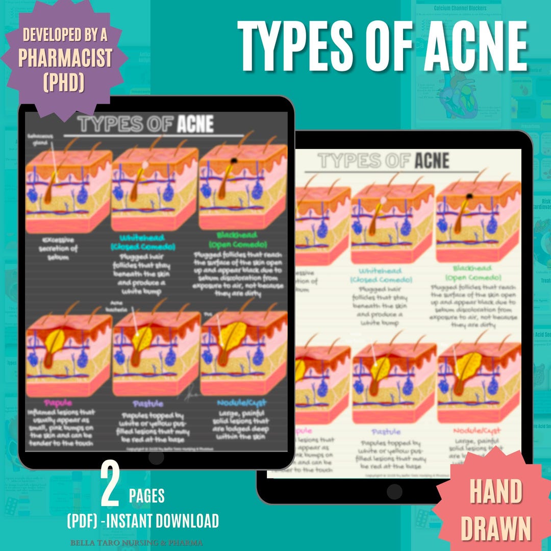 Esthetician Skin Acne Diagrams | Hand-drawn Types of Acne Face | Skin ...
