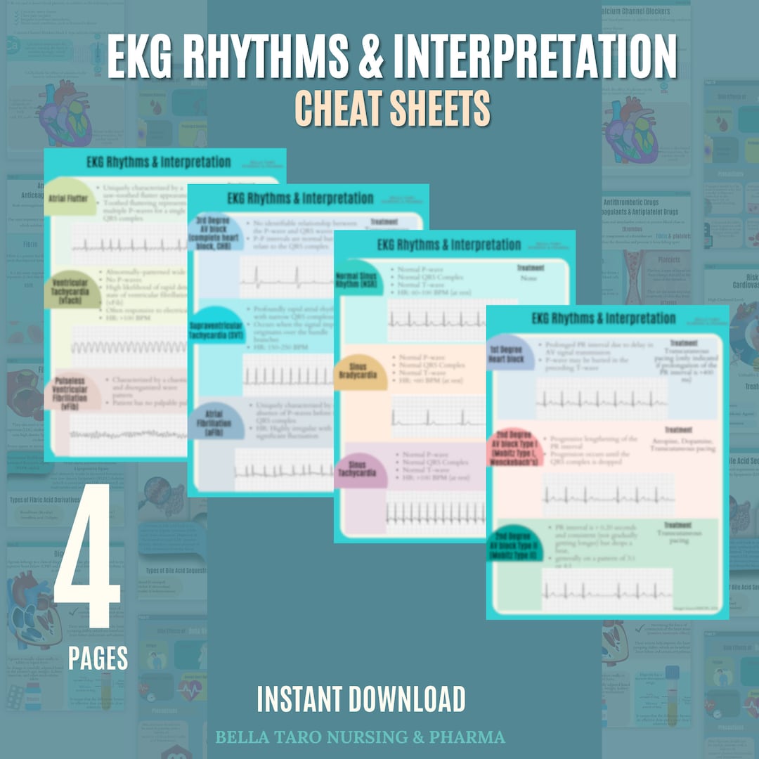 EKG Rhythms & Interpretation Cheat Sheets | EKG Arrhythmias | ECG ...