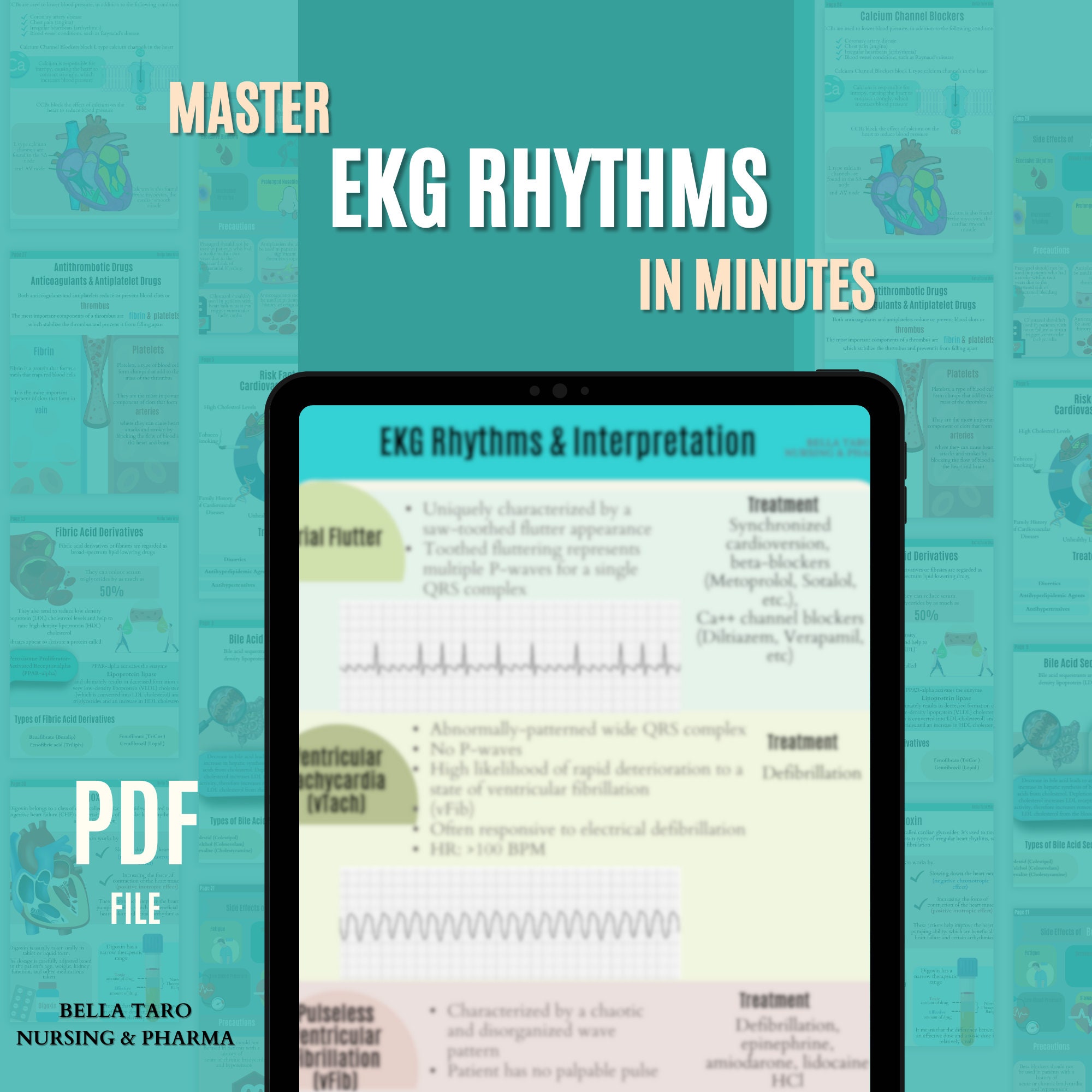 EKG Rhythms & Interpretation Cheat Sheets | EKG Arrhythmias | ECG ...