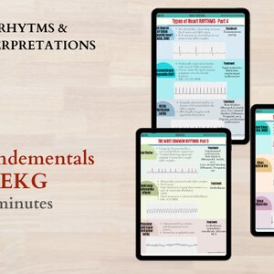 EKG Interpretation Study Guide | EKG Arrhythmias | ECG | Nursing ...