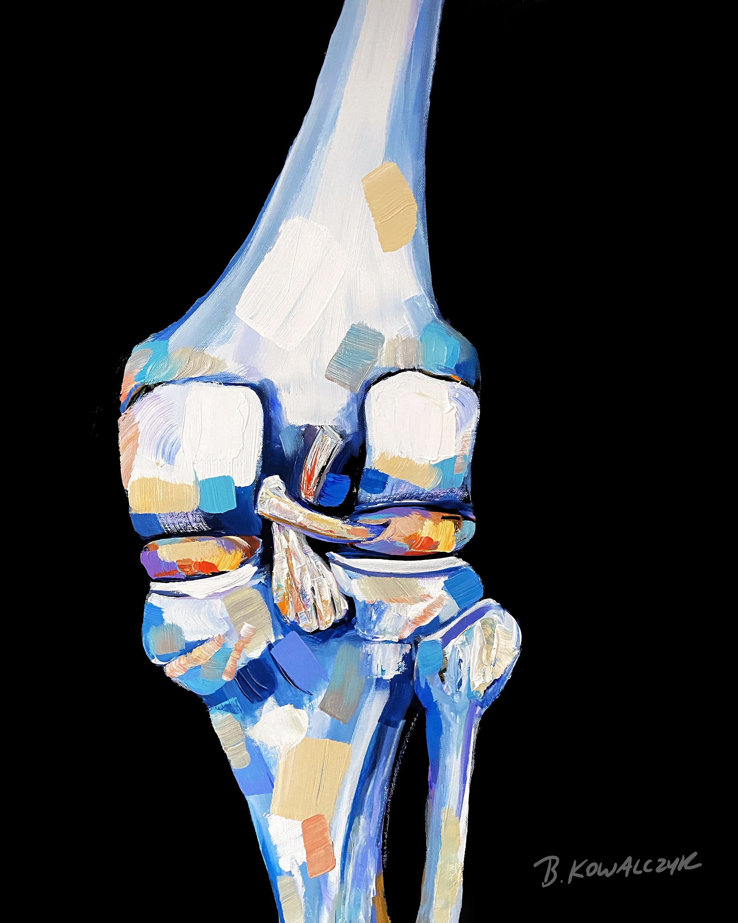 Posterior Knee Paper PRINT - Etsy