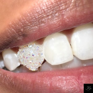 Pixie Dust Tooth Gems With Swarovski Crystals - Etsy