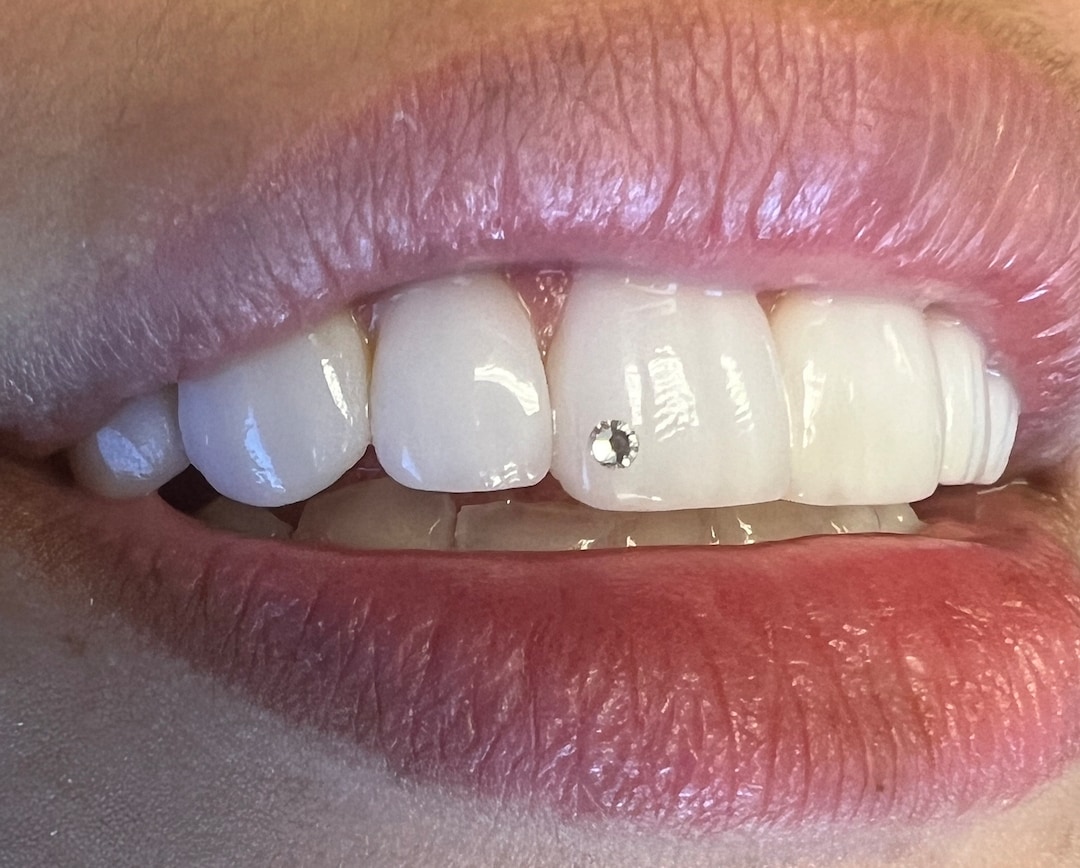 10pc Tooth Gem 100% Swarovski Crystal (clear) - Etsy