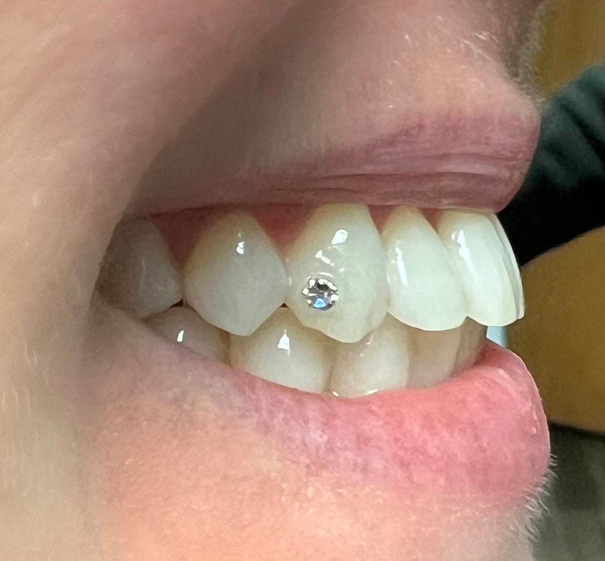 10pc Tooth Gem 100% Swarovski Crystal (clear) - Etsy