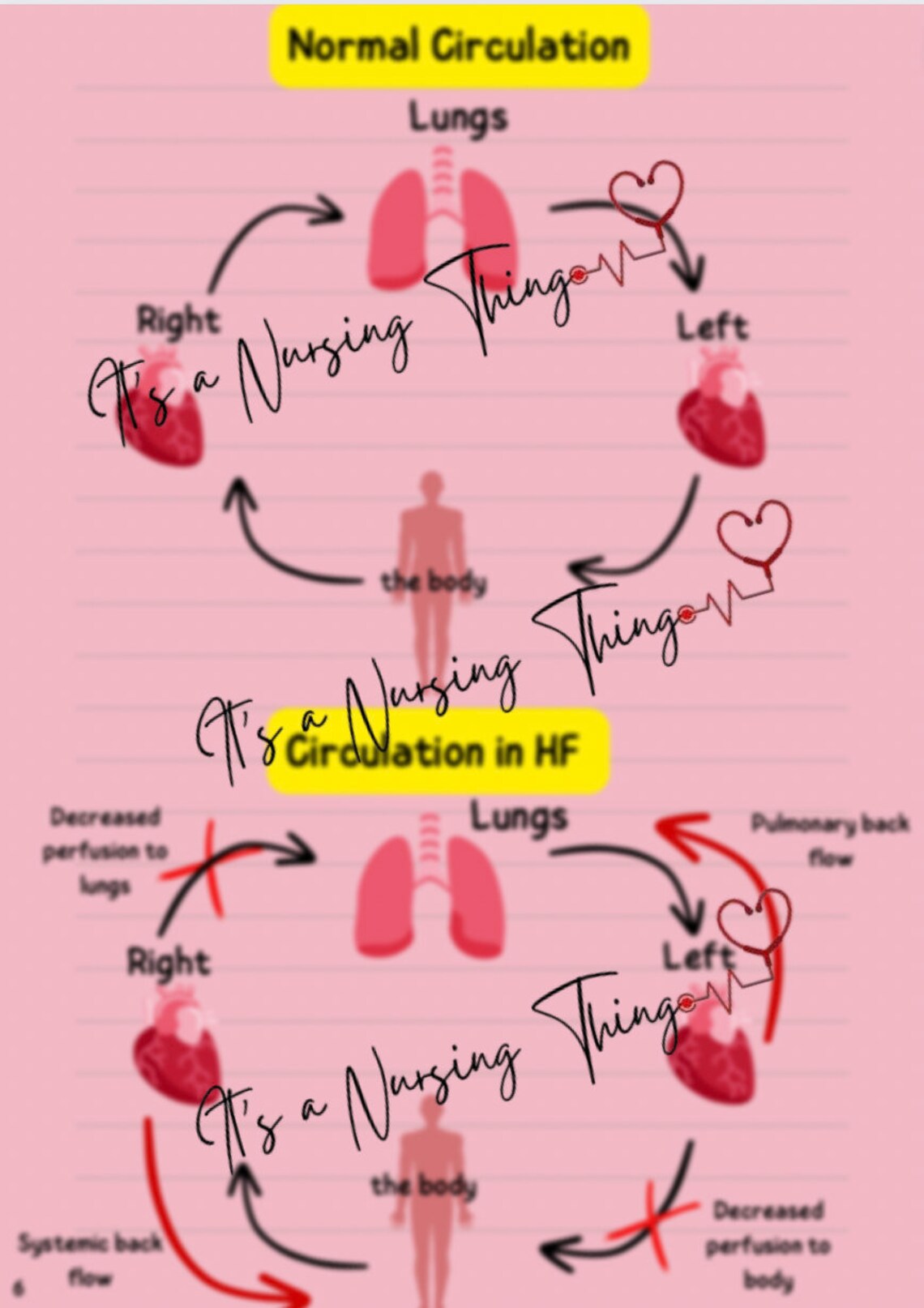 Heart Failure Study Guide - Etsy