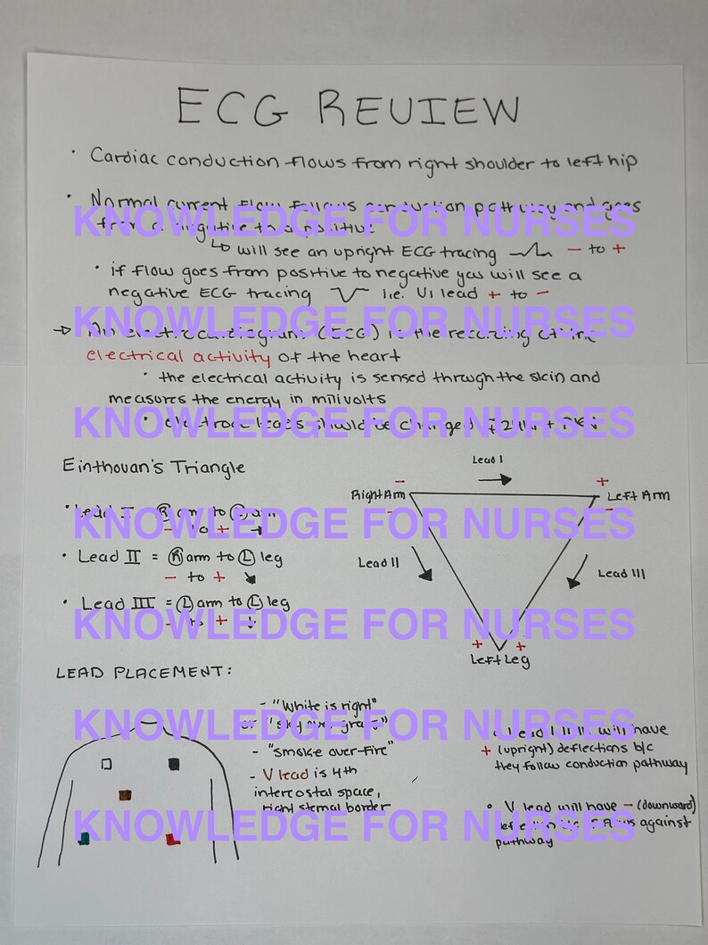 Understanding the ECG- Quick Review Bundle for Nurses/nursing Students ...