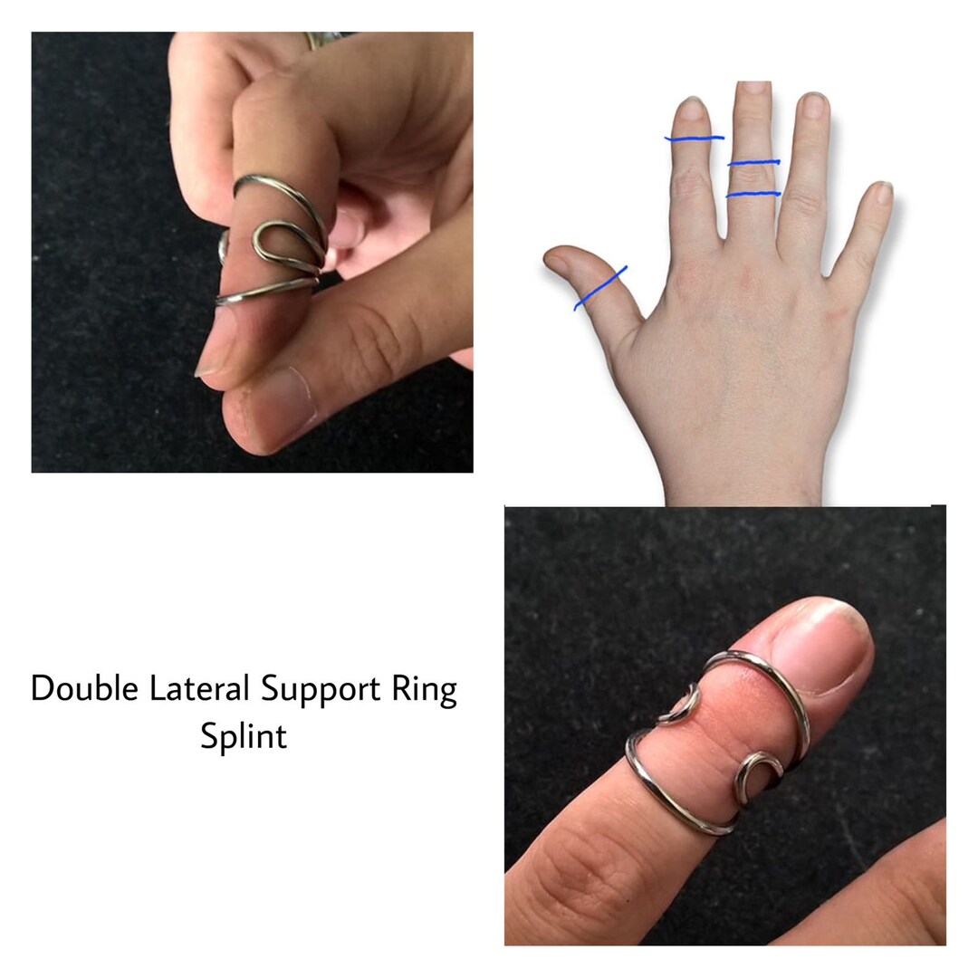 Double Lateral Support Ring Splint Sideways Lateral Deviation Sterling ...