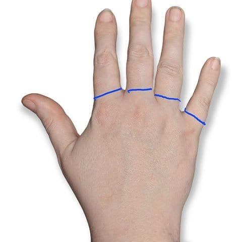 Swirl Hand MCP Hypermobility Splint Arthritis Finger MCP Joints Splint ...