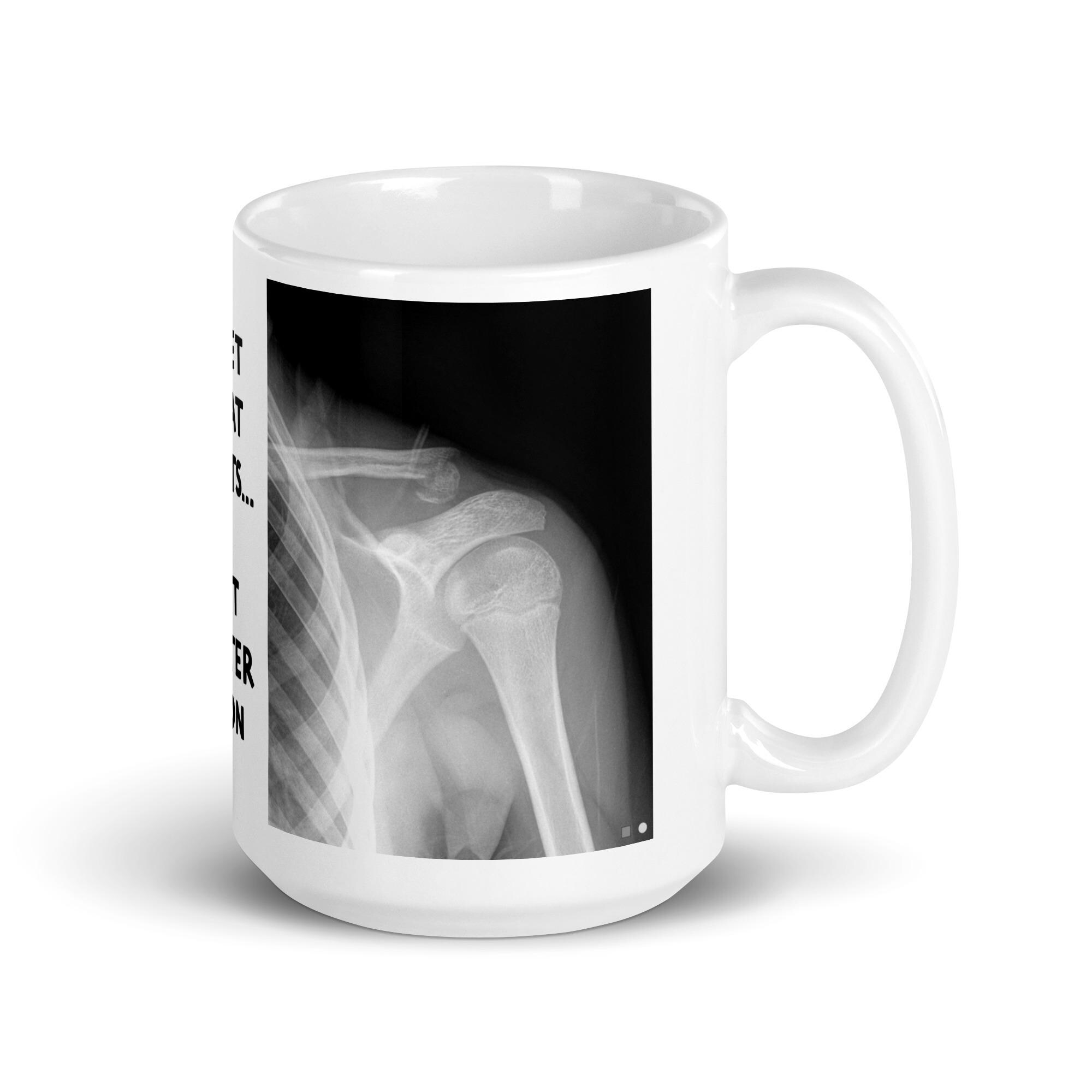 Shoulder Surgery Mug, Funny Get Well Mug, Shoulder Injury Gift ...