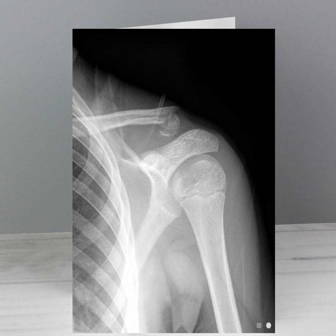 Shoulder Surgery Card, Funny Surgery Card, Funny Get Well, Shoulder ...