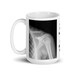 Shoulder Surgery Mug, Funny Get Well Mug, Shoulder Injury Gift ...