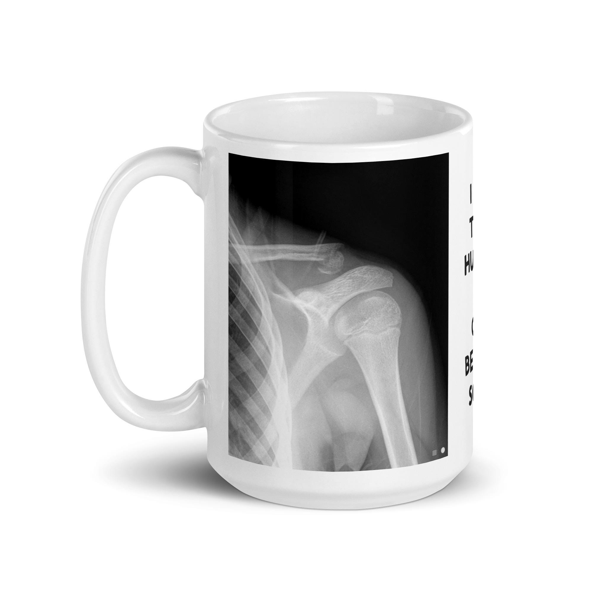 Shoulder Surgery Mug, Funny Get Well Mug, Shoulder Injury Gift ...
