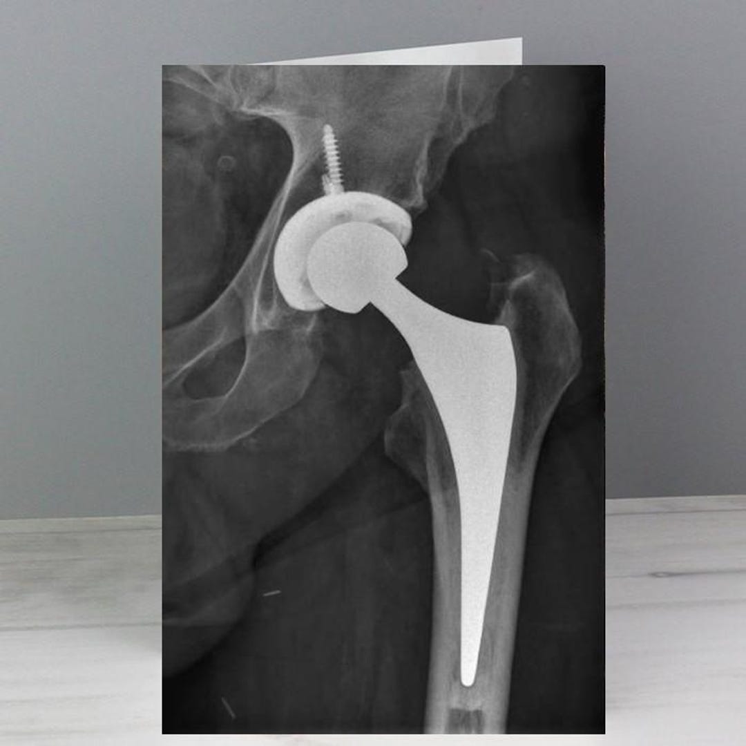 Hip Surgery Card, Funny Surgery Card, Get Well Card, Hip Replacement ...