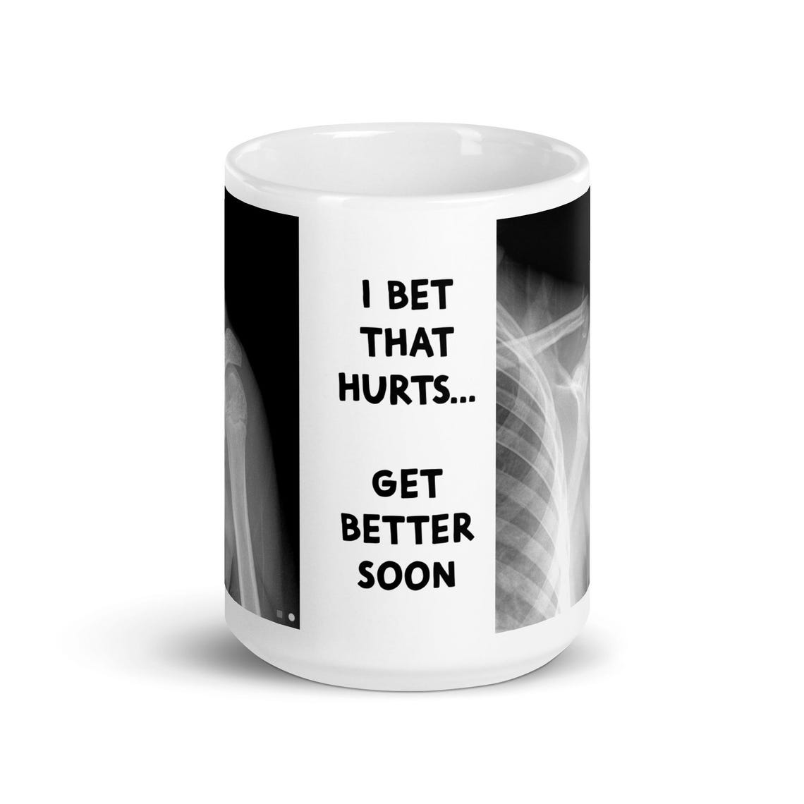 Shoulder Surgery Mug, Funny Get Well Mug, Shoulder Injury Gift ...