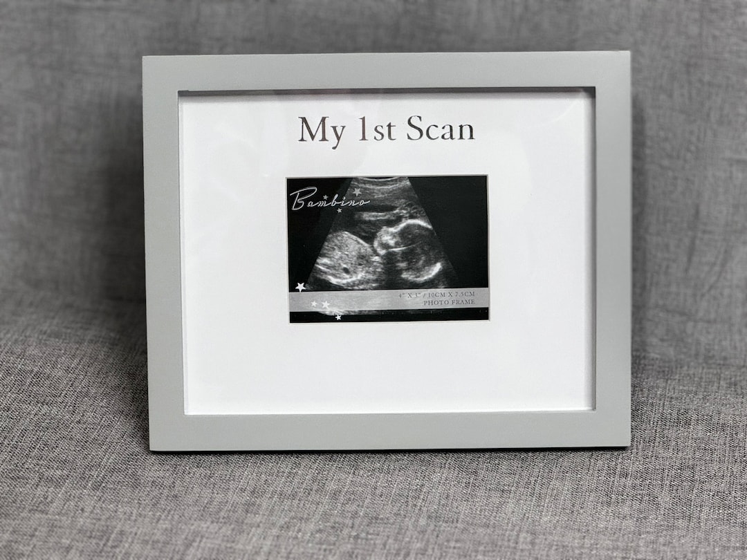 Baby's First Scan Frame - Etsy