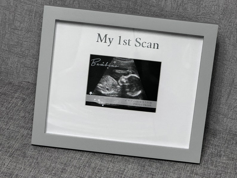 Baby's First Scan Frame - Etsy
