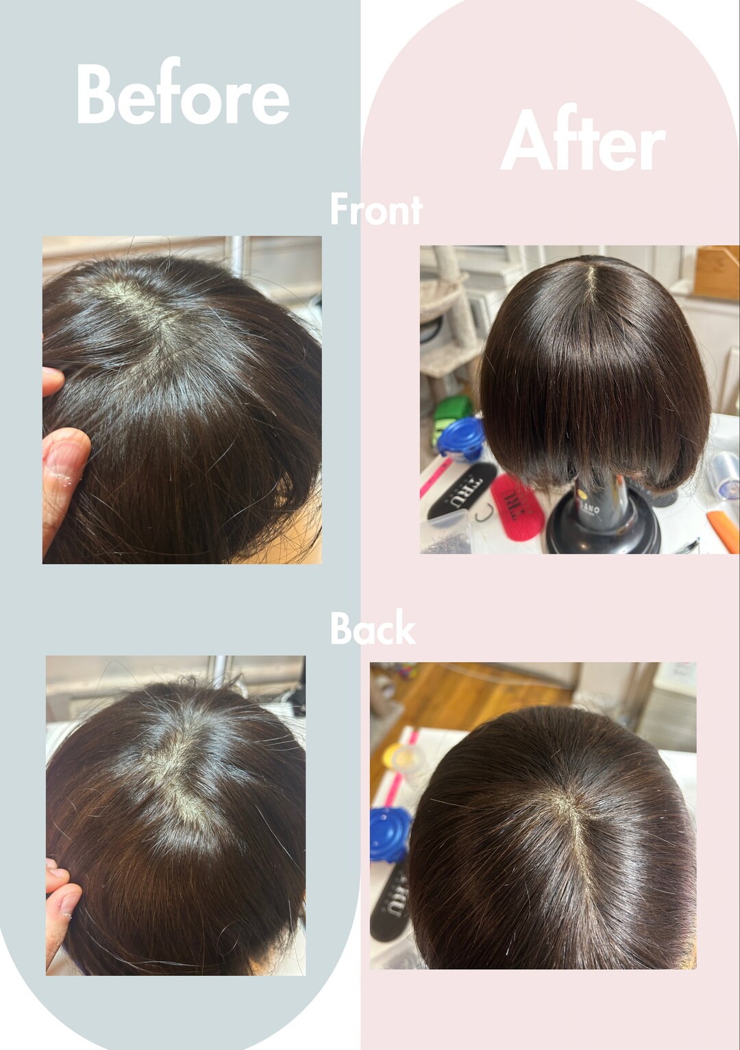 Wig Ventilating Services Fill in Balding Wigs - Etsy